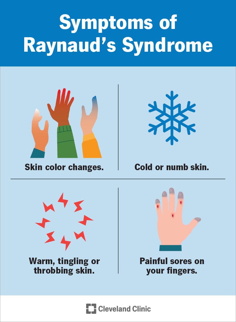 Raynaud’s and Cold Sensitivity: What You Should Know - Ried Physical ...